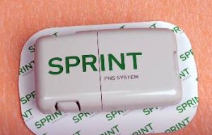 Sprint PNS System Reviews: Is It Worth It?