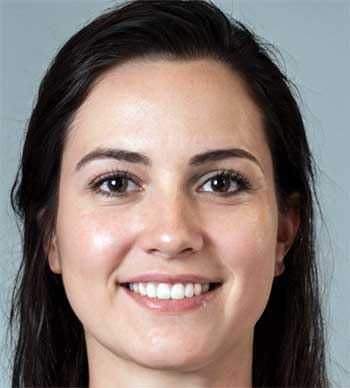 Almased Diet Reviews From My Personal Experience